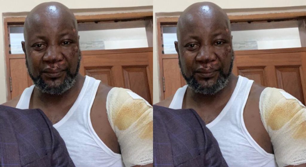 NBS TV's Samson Kasumba survives deadly accident. - Kampala Express